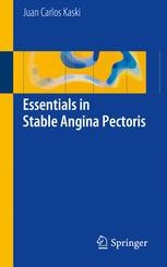 Essentials in Stable Angina Pectoris | Springer Nature Link (formerly ...
