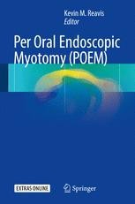 Per Oral Endoscopic Myotomy (POEM) | Springer Nature Link (formally ...