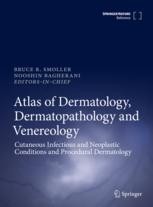 Atlas of Dermatology, Dermatopathology and Venereology: Cutaneous ...