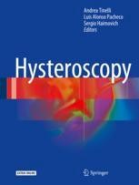 Hysteroscopy | Springer Nature Link