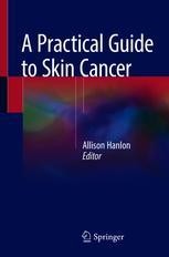 A Practical Guide to Skin Cancer | SpringerLink