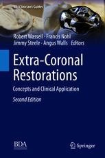 Extra-Coronal Restorations: Concepts and Clinical Application ...