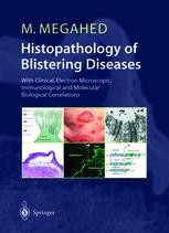Histopathology of Blistering Diseases: With Clinical, Electron ...