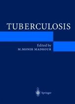 Tuberculosis | SpringerLink