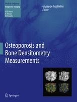 Osteoporosis and Bone Densitometry Measurements | SpringerLink