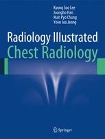Radiology Illustrated: Chest Radiology | SpringerLink