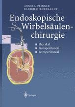 Endoskopische Wirbelsäulenchirurgie: thorakal · transperitoneal · retroperitoneal | SpringerLink