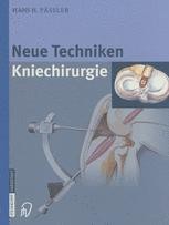 Neue Techniken Kniechirurgie | SpringerLink