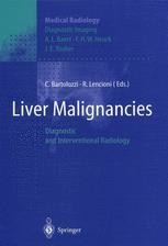 Liver Malignancies: Diagnostic and Interventional Radiology | SpringerLink