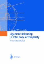 Ligament Balancing in Total Knee Arthroplasty: An Instructional Manual ...
