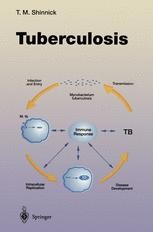 Tuberculosis | SpringerLink