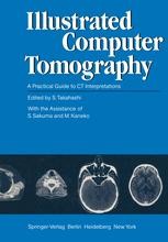 Illustrated Computer Tomography: A Practical Guide to CT ...