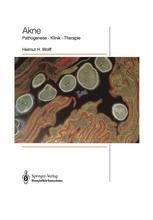 Akne: Pathogenese — Klinik — Therapie | SpringerLink