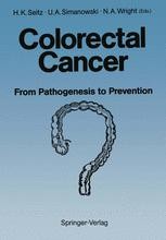 Colorectal Cancer: From Pathogenesis to Prevention? | SpringerLink