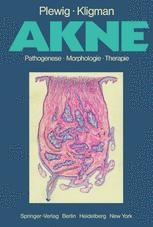 Akne: Pathogenese Morphologie Therapie | SpringerLink