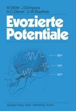 Evozierte Potentiale: SEP - VEP - AEP | Springer Nature Link (formerly SpringerLink)