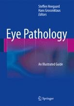 Eye Pathology: An Illustrated Guide | SpringerLink