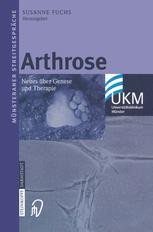 Arthrose: Neues über Genese und Therapie | SpringerLink