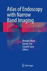 Atlas of Endoscopy with Narrow Band Imaging | SpringerLink