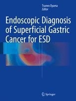 Endoscopic Diagnosis of Superficial Gastric Cancer for ESD | SpringerLink