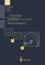 Essential Illustrated Neurosurgery | Springer Nature Link (formerly ...