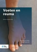 Voeten en reuma | SpringerLink