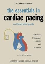 the essentials in cardiac pacing: An Illustrated Guide | SpringerLink