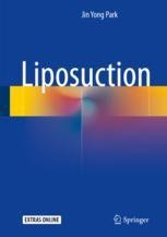 Liposuction | SpringerLink