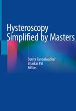 Hysteroscopy Simplified by Masters | Springer Nature Link