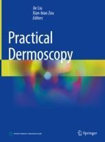 Practical Dermoscopy | Springer Nature Link (formerly SpringerLink)