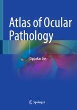 Atlas of Ocular Pathology | Springer Nature Link (formerly SpringerLink)