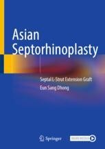 Asian Septorhinoplasty: Septal L-Strut Extension Graft | SpringerLink