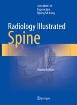 Radiology Illustrated: Spine | SpringerLink