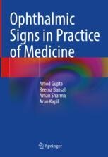 Ophthalmic Signs in Practice of Medicine | SpringerLink