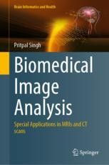 Biomedical Image Analysis: Special Applications in MRIs and CT scans | SpringerLink