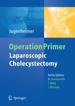 Laparoscopic Cholecystectomy | SpringerLink