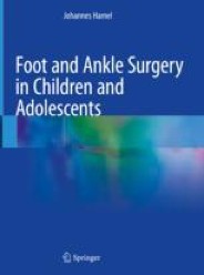 Skew Foot/Serpentine Foot | SpringerLink