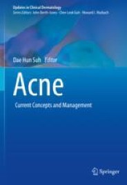 Clinical Features and Differential Diagnosis of Acne Vulgaris ...