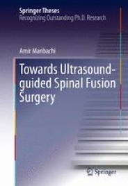 Towards Ultrasound-guided Spinal Fusion Surgery | SpringerLink
