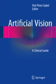 The Intracortical Visual Prosthesis Project | SpringerLink