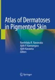 Photodermatosis | SpringerLink