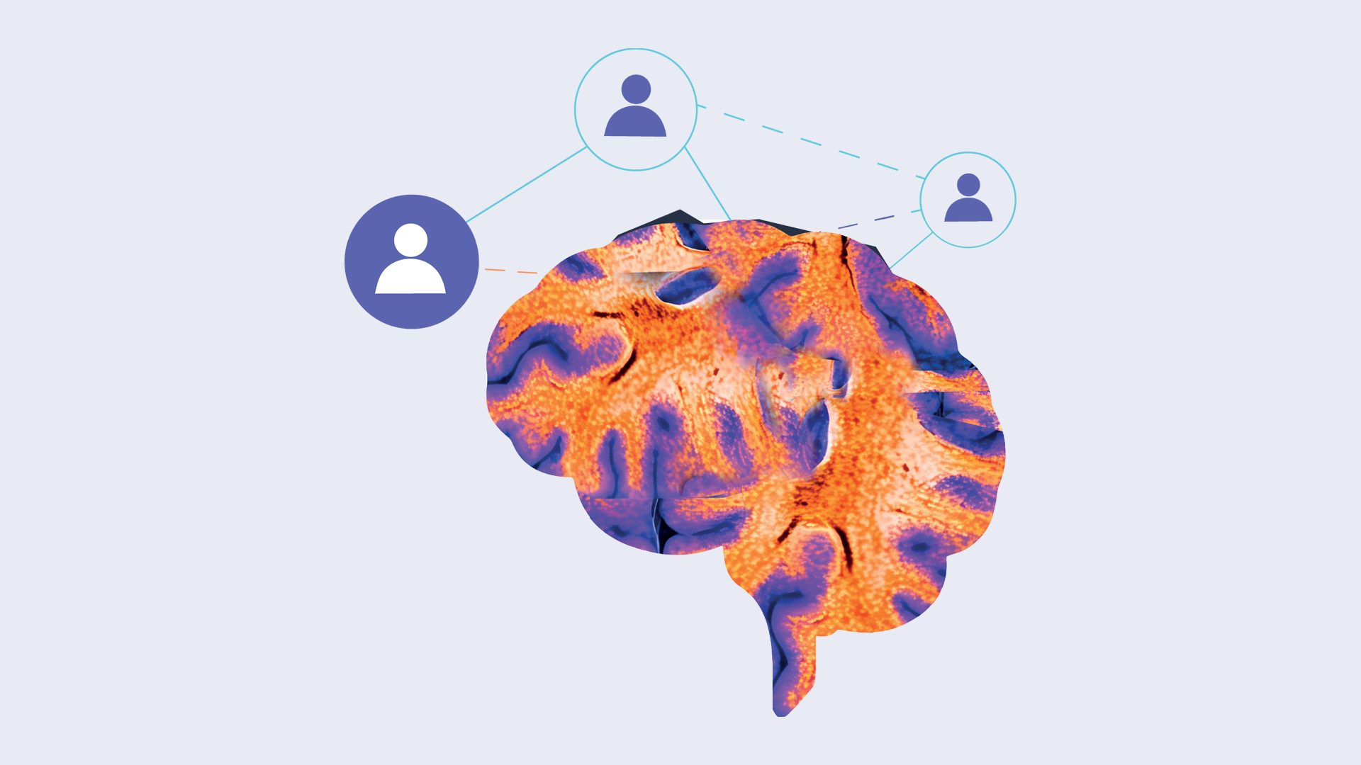 Computed Tomography | [99mTc]MIBI SPECT/CT for Identifying Dystonic ...