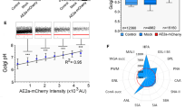 Golgi phosphoprotein 2 (GOLPH2/GP73/GOLM1) interacts with secretory ...