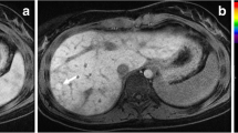 Inter-reader agreement and correlation of VAST, Fontan liver MRI score ...