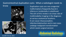 Enteric duplication cysts in children: varied presentations, varied ...