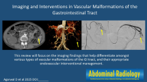 Colonic Arteriovenous Malformations | SpringerLink