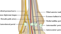 Mini-open vs. Transfibular Approach for Ankle Arthrodesis, Which ...