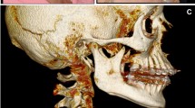 Changes in the Facial Skeleton With Aging: Implications and Clinical ...