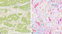 Trop-2-Expression in soliden Tumoren | Die Pathologie | Springer Nature ...