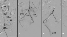 Superior rectal artery embolization for bleeding internal hemorrhoids ...